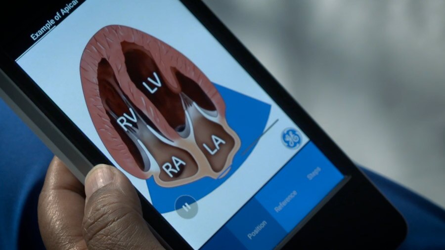 Vscan Extend Portable Ultrasound | GE Healthcare