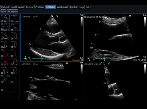 Centricity Cardio Enterprise | GE Healthcare