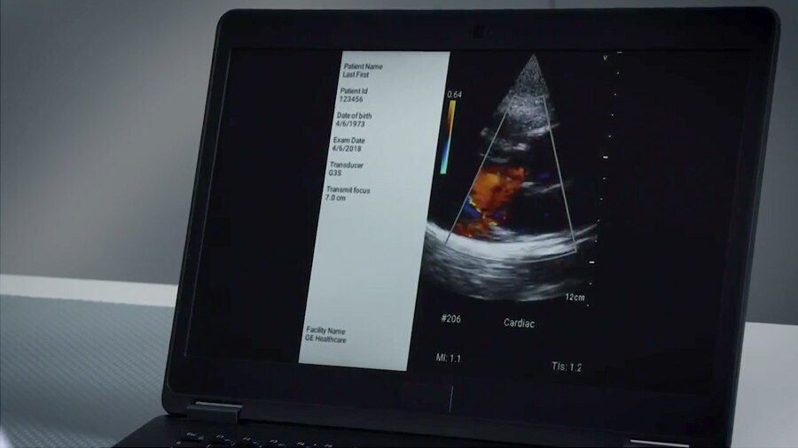 Vscan Extend Portable Ultrasound | GE Healthcare