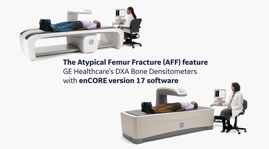 INCIPIENT ATYPICAL FEMUR FRACTURES | GE Healthcare