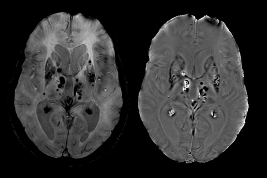 SWAN | GE Healthcare