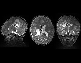 Magnetic Resonance Imaging | GE Healthcare