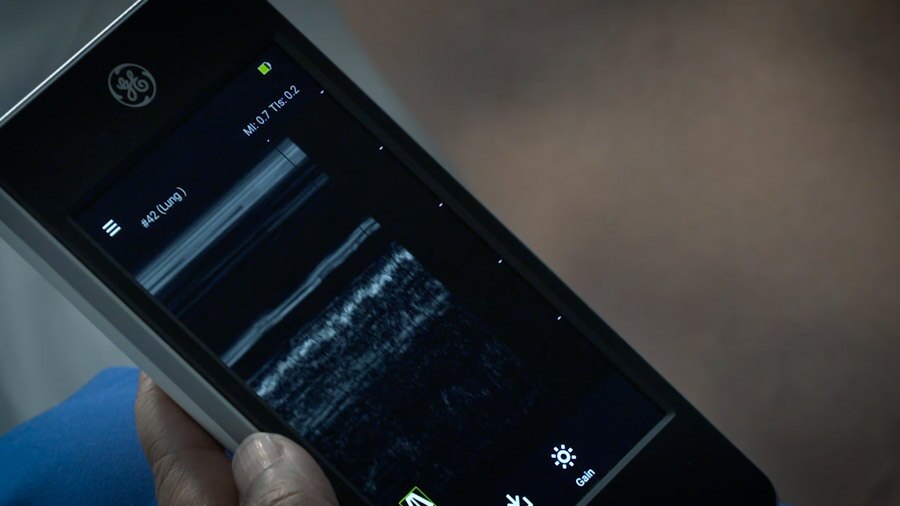 Vscan Extend Portable Ultrasound | GE Healthcare