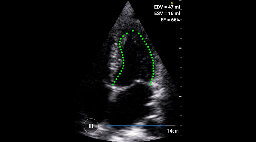 Vscan Extend Portable Ultrasound | GE Healthcare