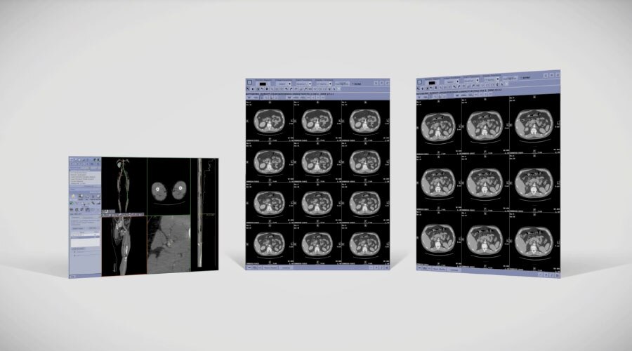 AW Server Integration with PACS | GE Healthcare