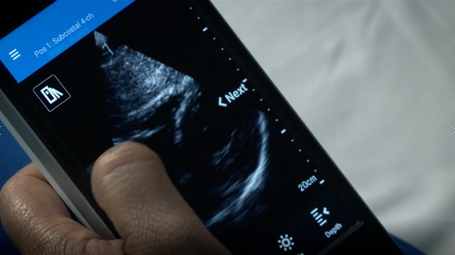 Vscan Extend Portable Ultrasound | GE Healthcare