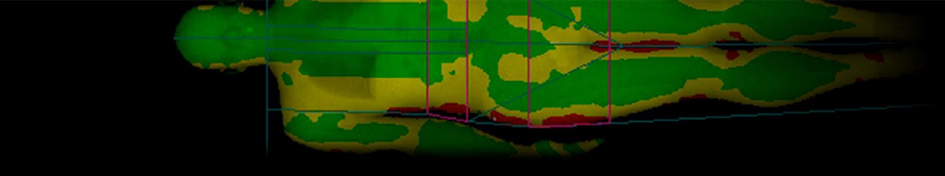 뼈 건강 | GE Healthcare (Korea)
