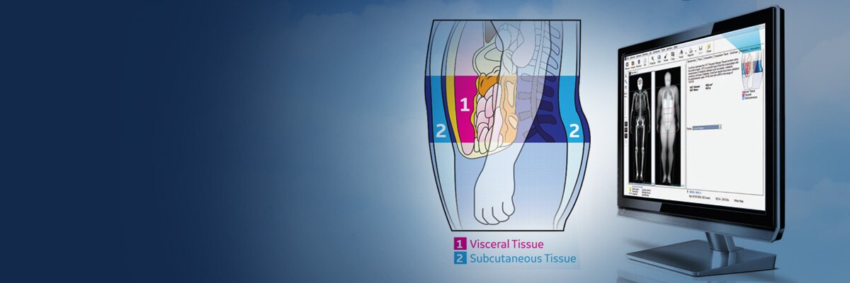 CoreScan | GE Healthcare (Korea)