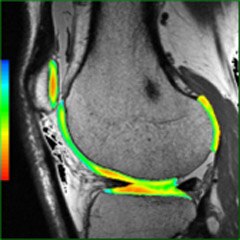Advanced Visualization | GE Healthcare (Korea)