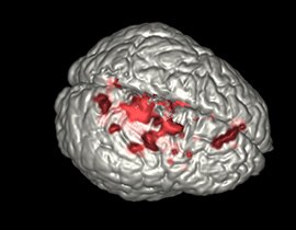 BrainWave | GE HealthCare (United States) BrainWave | GE HealthCare (United States)
