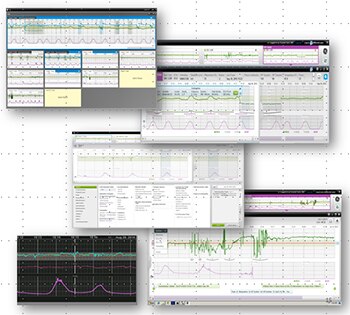 Centricity Perinatal Software | GE Healthcare