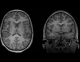 BRAVO | GE HealthCare (Korea)