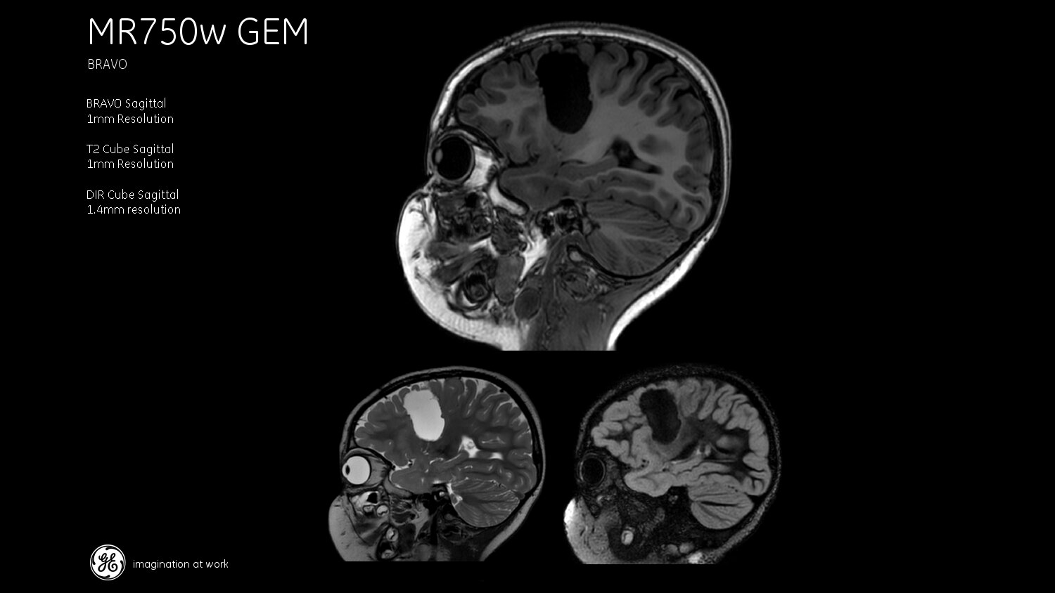 BRAVO | GE Healthcare (Korea)