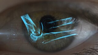 Radiography | GE HealthCare (Korea)