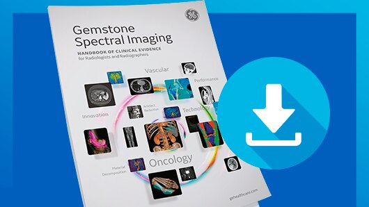 Revolution Apex CT System | GE Healthcare UK | GE Healthcare (Korea)