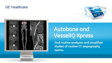 Autobone & VesselIQ Xpress | GE Healthcare (Korea)