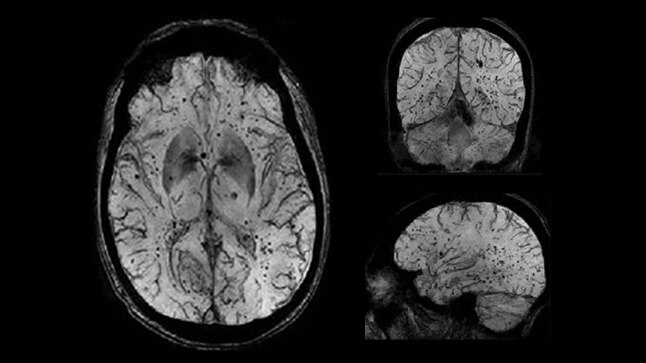 Neuro Imaging | GE Healthcare (Korea)