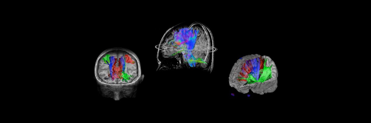 Neuro Imaging | GE Healthcare (Korea)