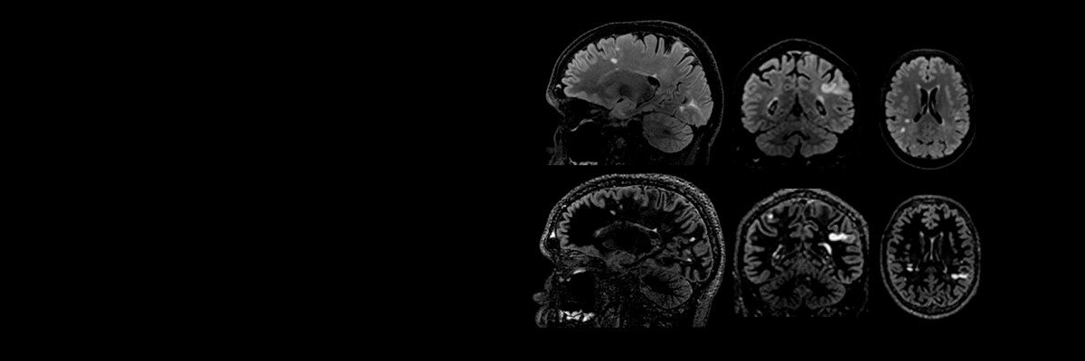 Neuro Imaging | GE Healthcare (Korea)