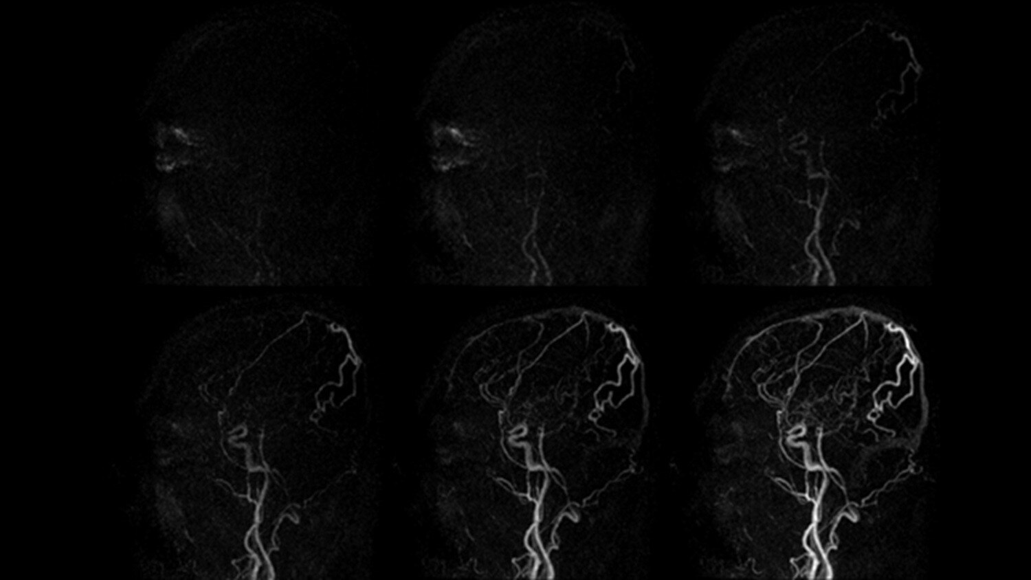 Neuro Imaging | GE HealthCare (Korea)