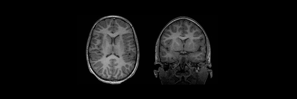 BRAVO | GE Healthcare (Korea)