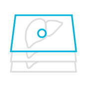 SIGNA™ Artist - 70cm | GE HealthCare (Korea)