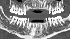 advanced visualization dentascan plus.