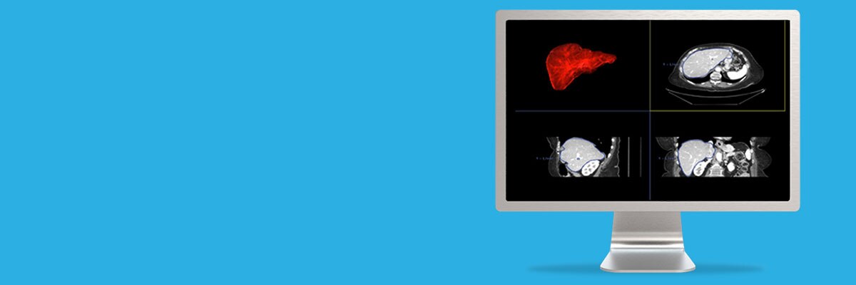 Hepatic VCAR | GE Healthcare (Korea)