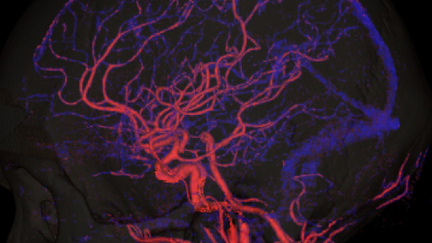 CT Advanced Visualization | GE Healthcare (Korea)