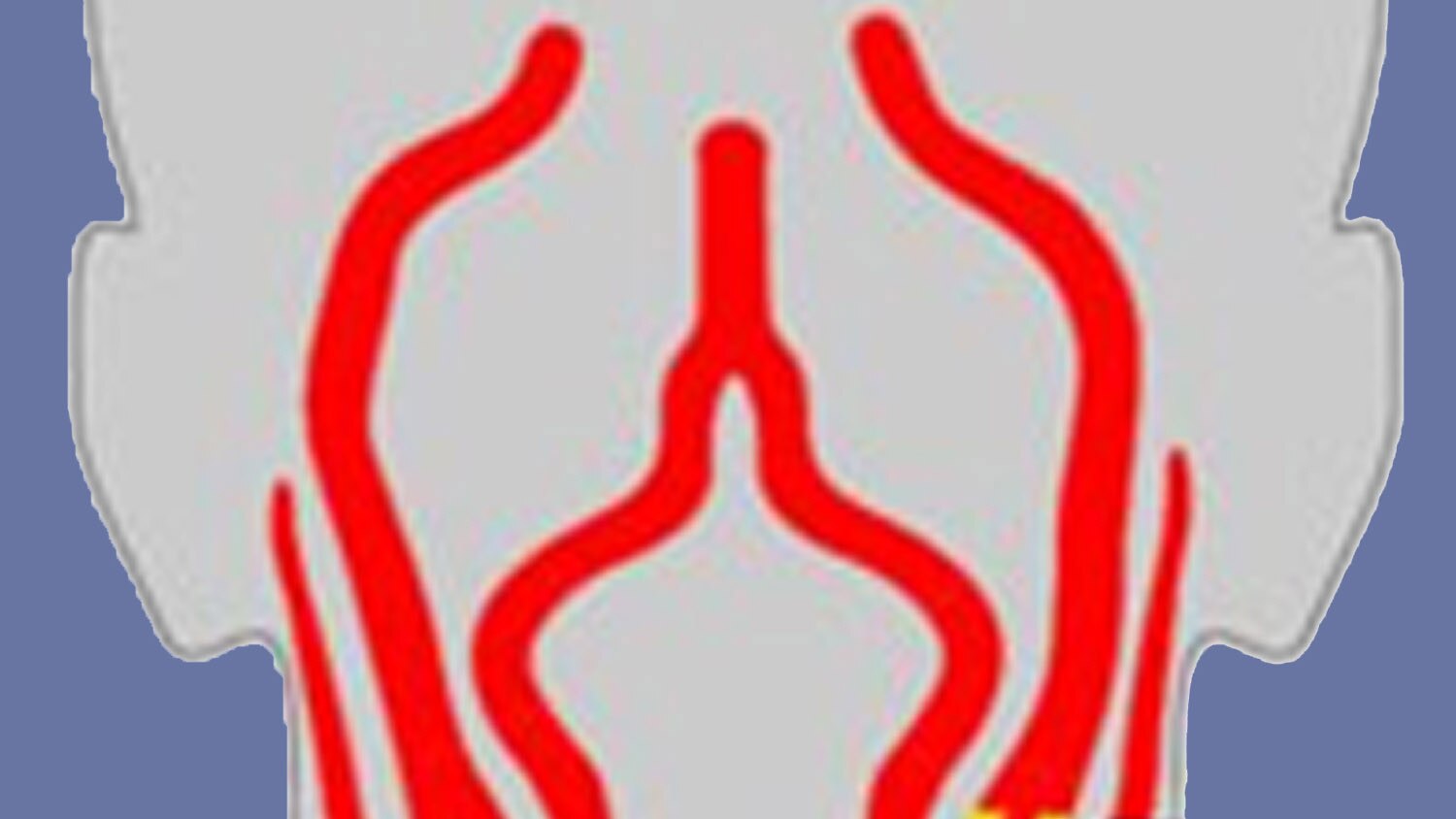 Vascular Advanced Visualization | GE Healthcare (Korea)